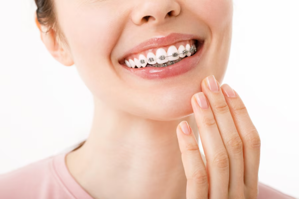 Choosing The Right Path Braces Vs Aligners For A Perfect Smile