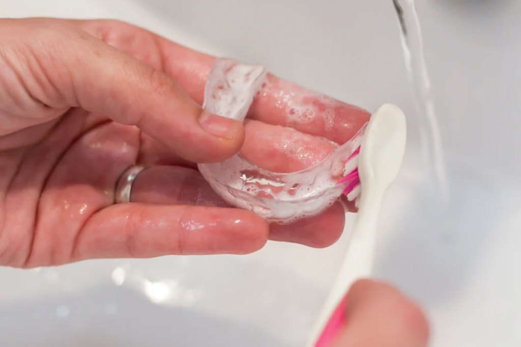 How to Clean Your Invisalign Aligners for a Fresh, Clear Look